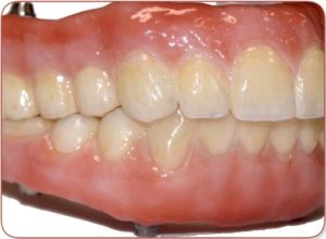 Comment calmer une douleur insupportable de l'appareil dentaire